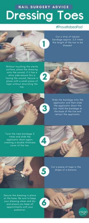 dressing-toes | A&A Podiatrists & Chiropodists