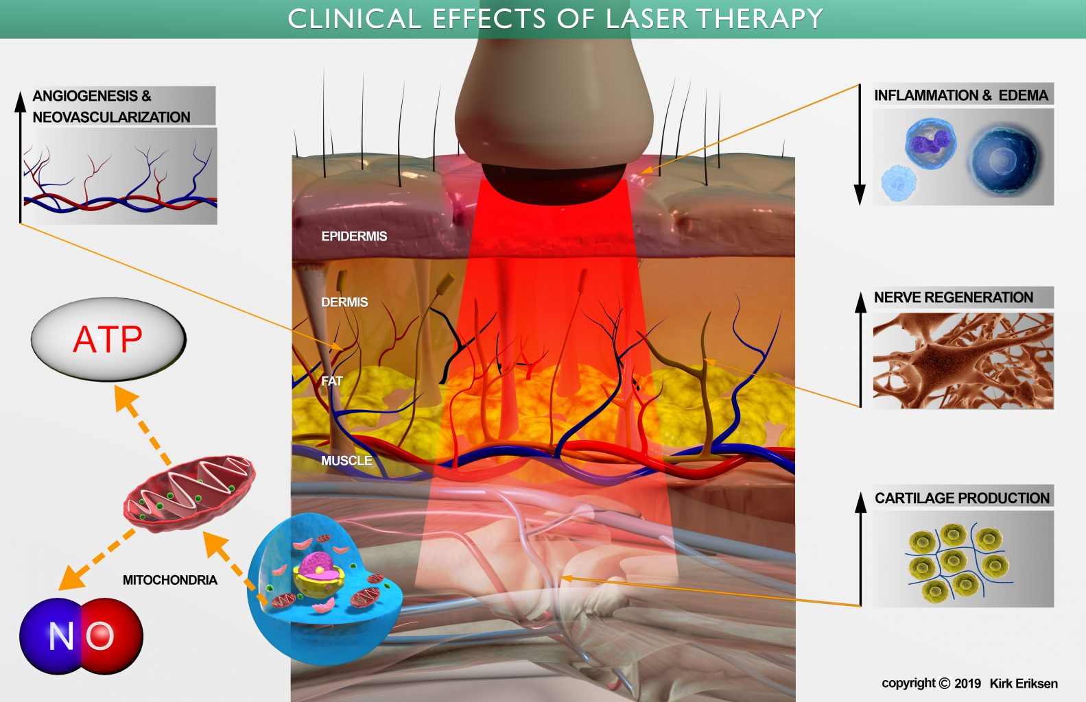 MLS Laser for inflammation | A&A Podiatrists & Chiropodists